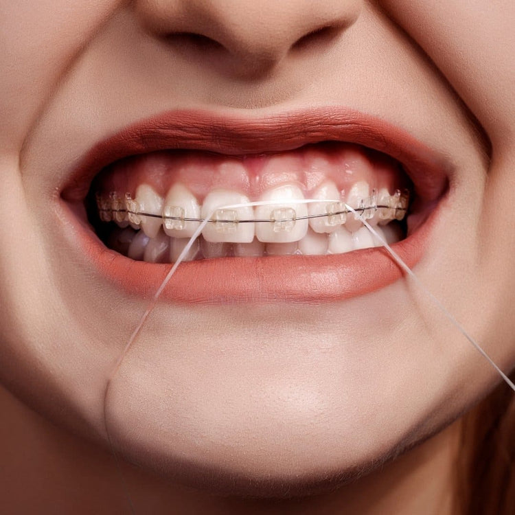 Flosii™ Water Flosser – Plaque-Free Smile in 2 Minutes | Gentle & Effective